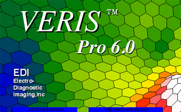 Veris ERG / mfERG - www.Cephalon.eu