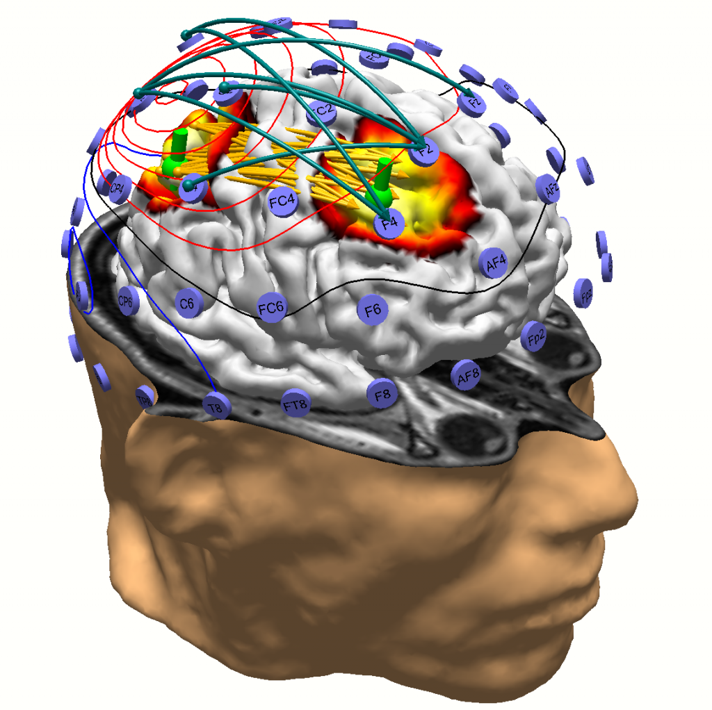 NeuroScan Archives - www.Cephalon.eu
