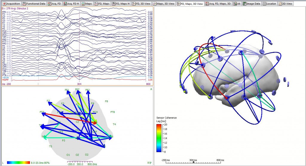 NeuroScan Archives - www.Cephalon.eu