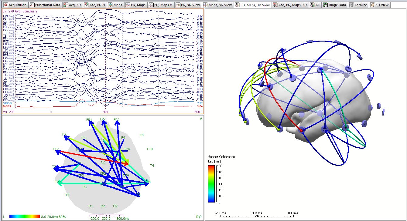 Neuroscan - EEG ERP EP - www.Cephalon.eu