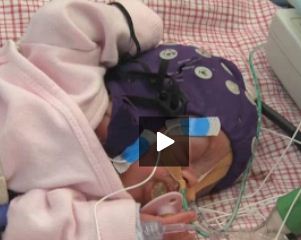 WaveGuard EEG Cap - www.Cephalon.eu