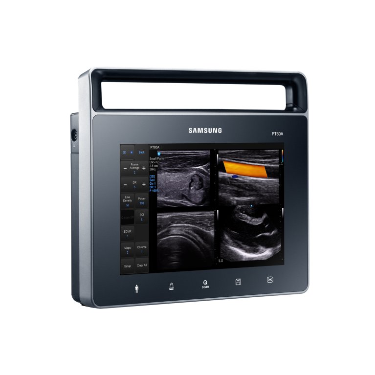 Ultrasound - www.Cephalon.eu