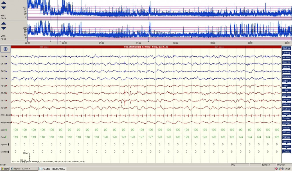 Neon cap - www.Cephalon.eu