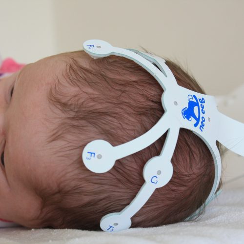 EEG - www.Cephalon.eu