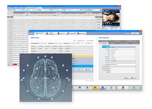 Stratus EEG - www.Cephalon.eu